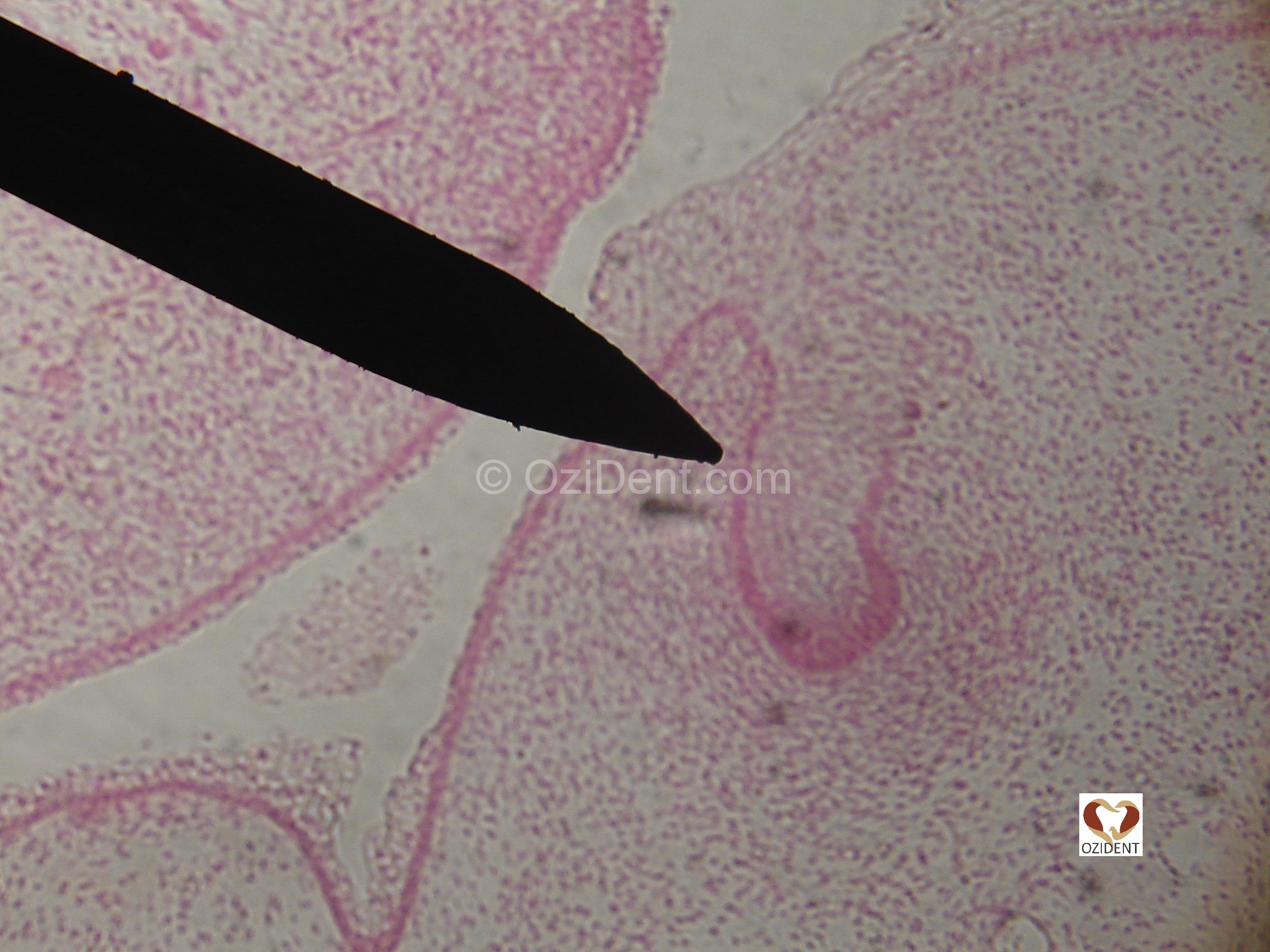 Bud Stage (11) - OziDent