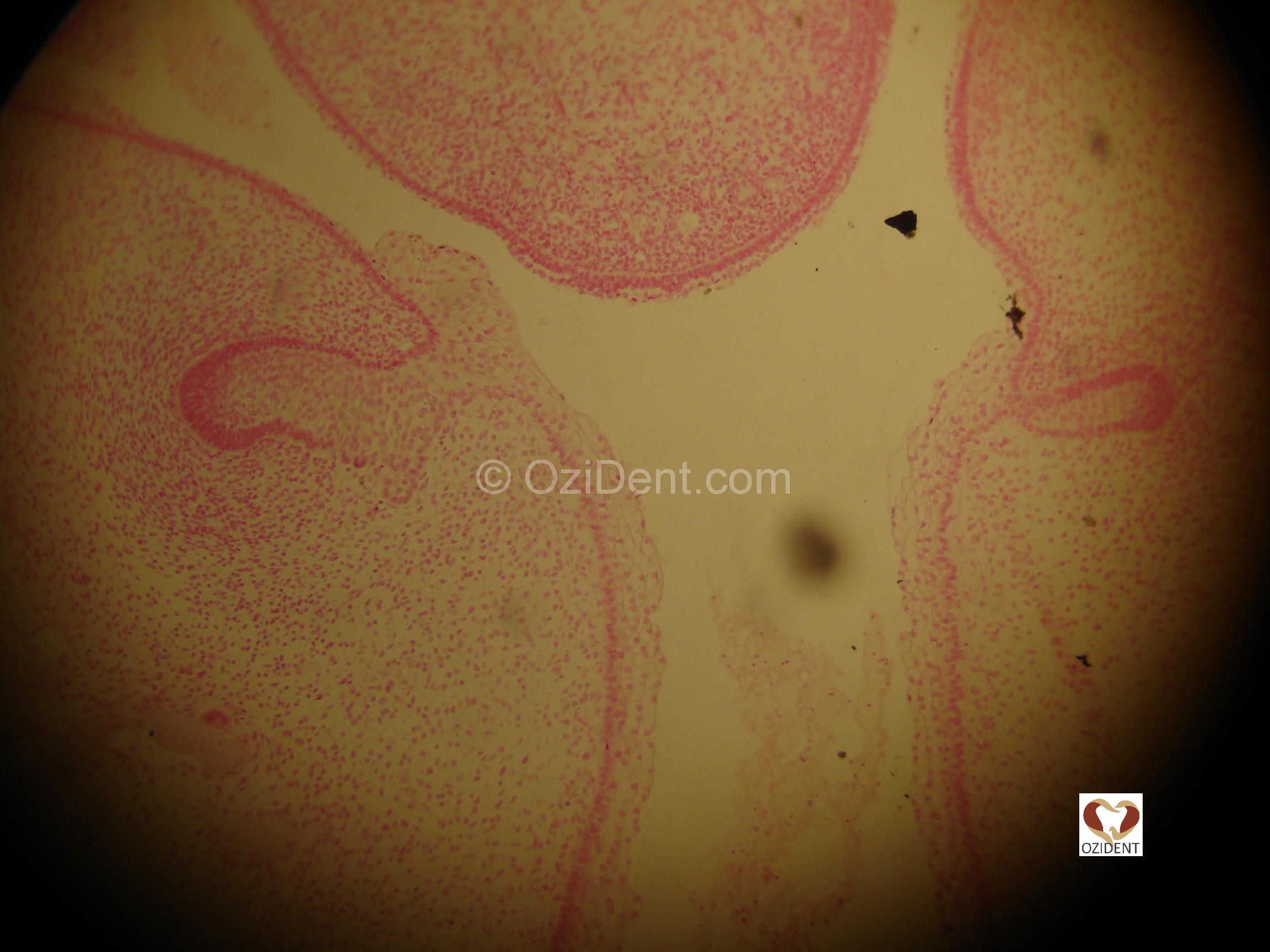 Bud Stage (6) - OziDent