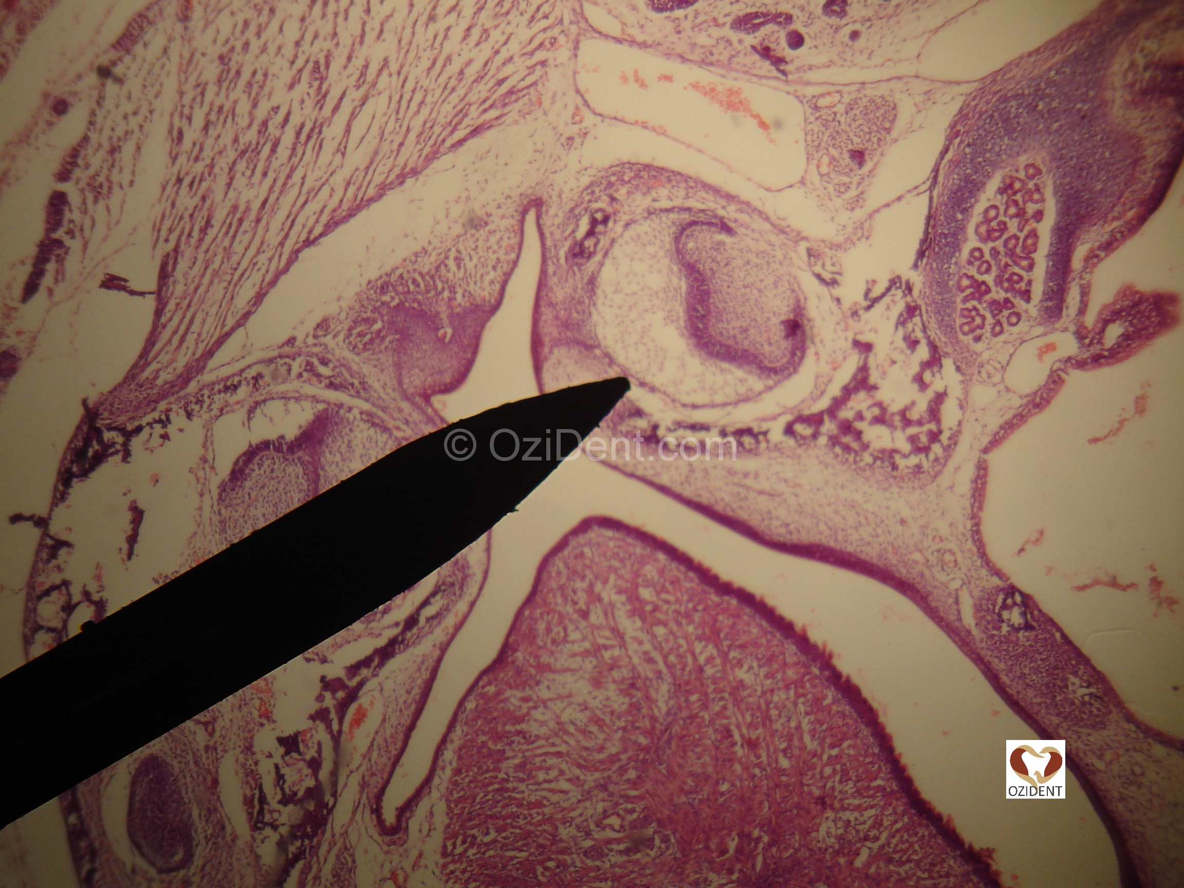 Early Bell Stage (10) - OziDent