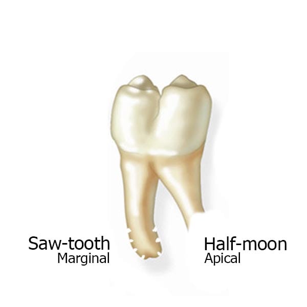 tooth-forms - OziDent